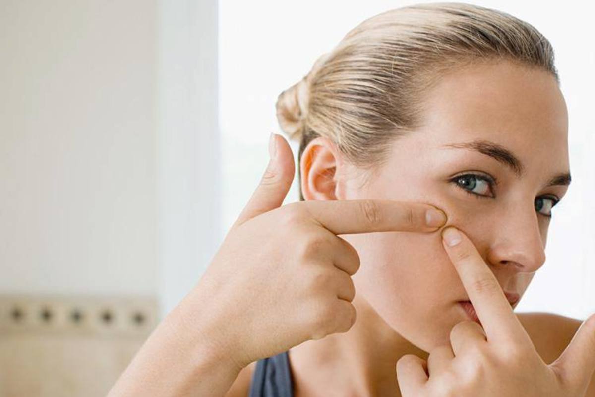 Come eliminare i punti neri difinitivamente | Donne Magazine Come eliminare i punti neri difinitivamente | Donne Magazine